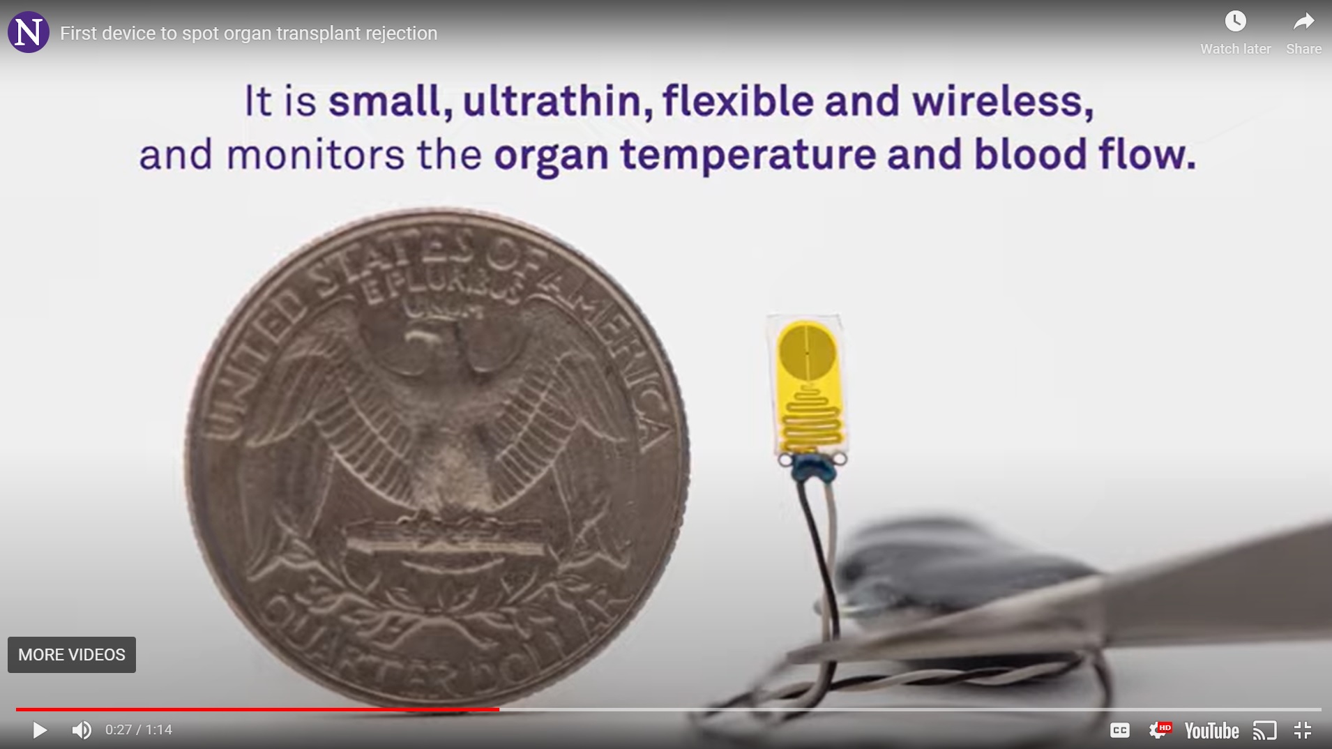 First device to monitor transplanted organs detects early signs of ...