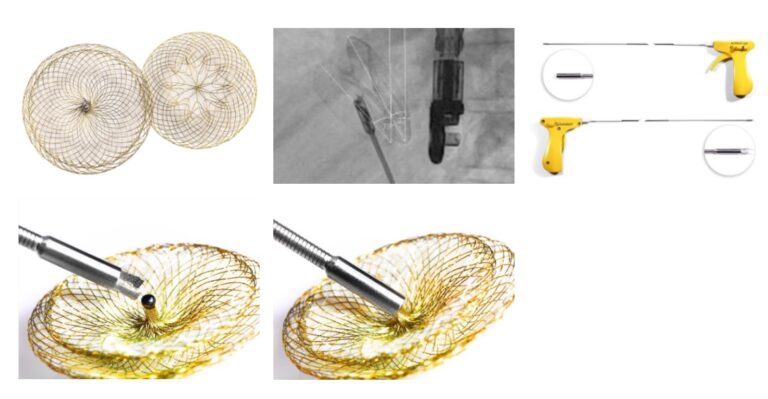 Occlutech(R) Announces FDA Approval of its Occlutech(R) ASD Occluder and Occlutech(R) Pistol ...