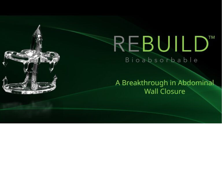 Absolutions receives FDA breakthrough designation for abdominal wall ...
