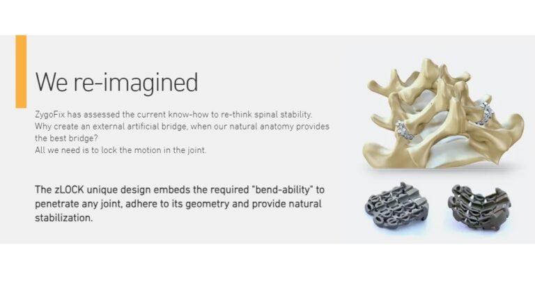 ZygoFix Receives FDA Clearance for its zLOCK Lumbar Facet Fixation ...