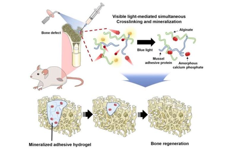 Injectable hydrogel uses harmless visible light to achieve bone ...