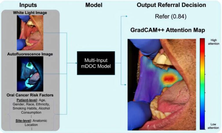 Phone detects oral cancer - Start Medical Product Development