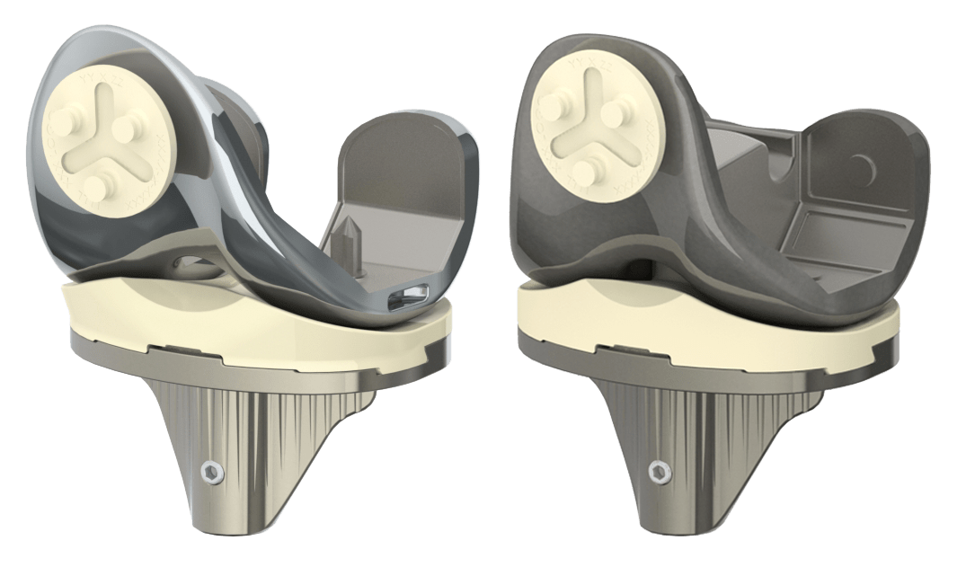 Optimotion Implants for knees - Start Medical Product Development