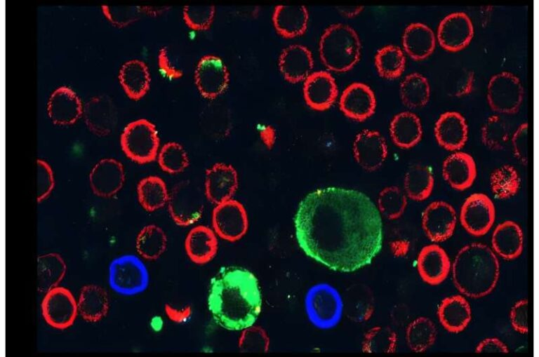 Cancer cells paralyze immune cells - Start Medical Product Development
